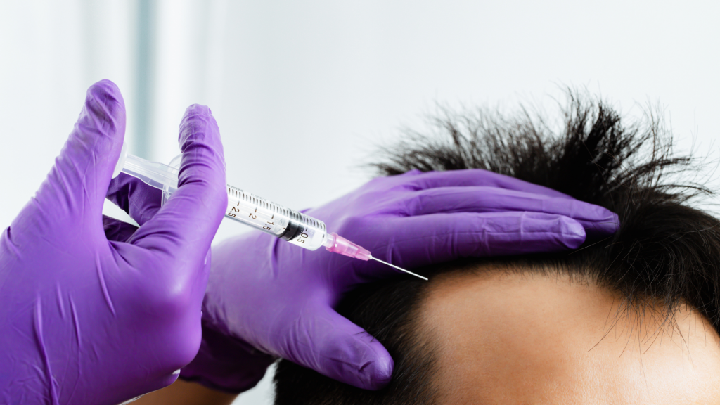 TRATAMIENTOS – Capil Clinic