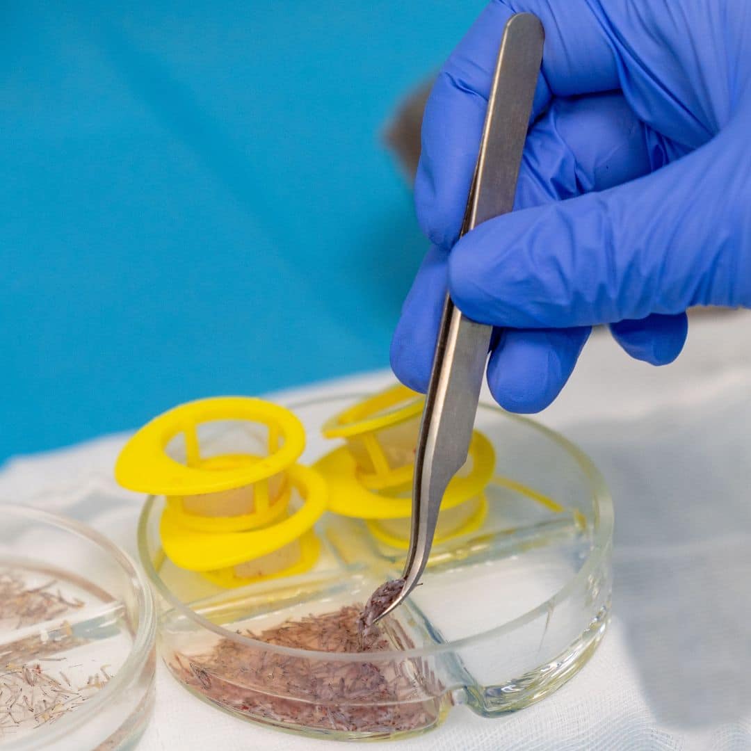 Descubre los Factores que Determinan el Número de Folículos en un ...